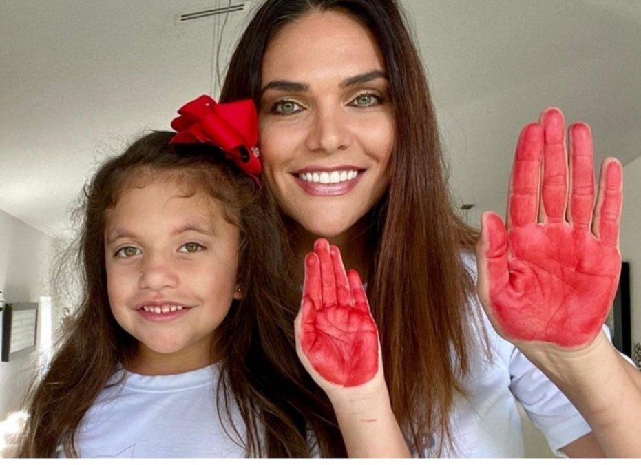 La cruel historia de esta ex Miss Venezuela: Lucha contra bullying