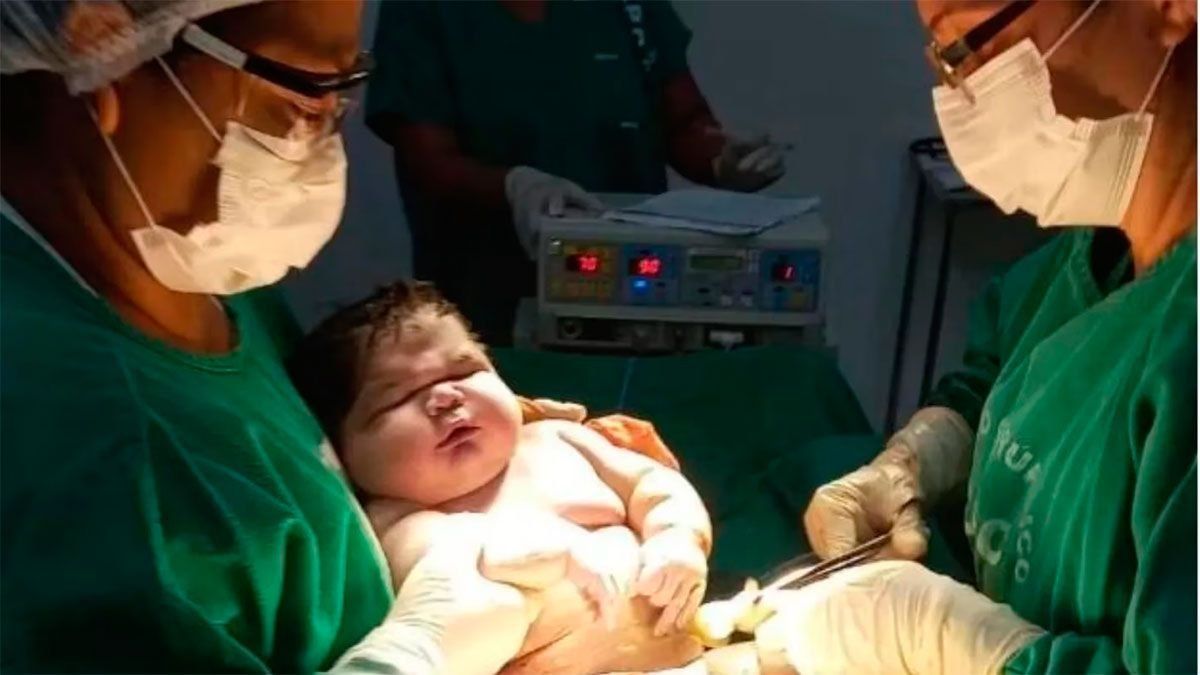 Superbebé de 7 kilos nació en Brasil y batió récord