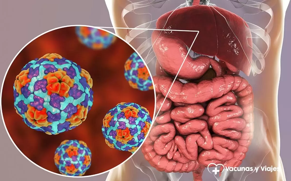 Asintomática Maria Tifoidea, escándalo y muerte en un nombre