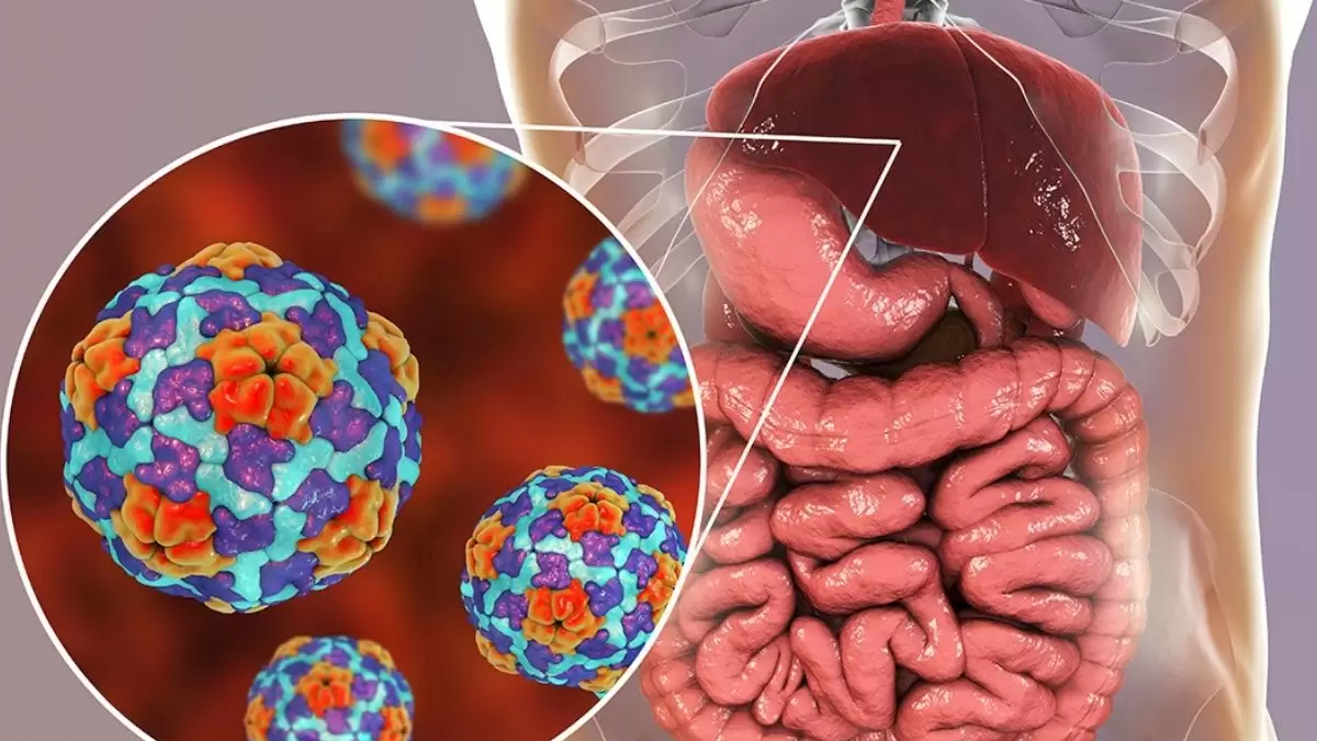 Asintomática Maria Tifoidea, escándalo y muerte en un nombre