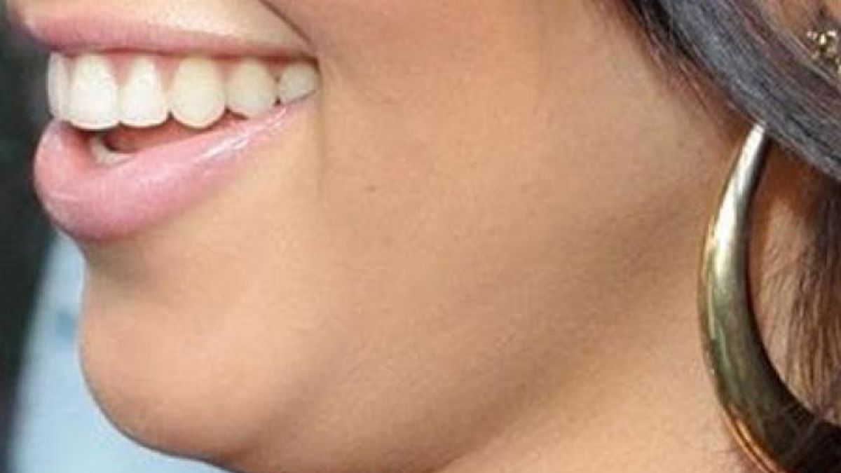 Estos 5 ejercicios reducen la papada