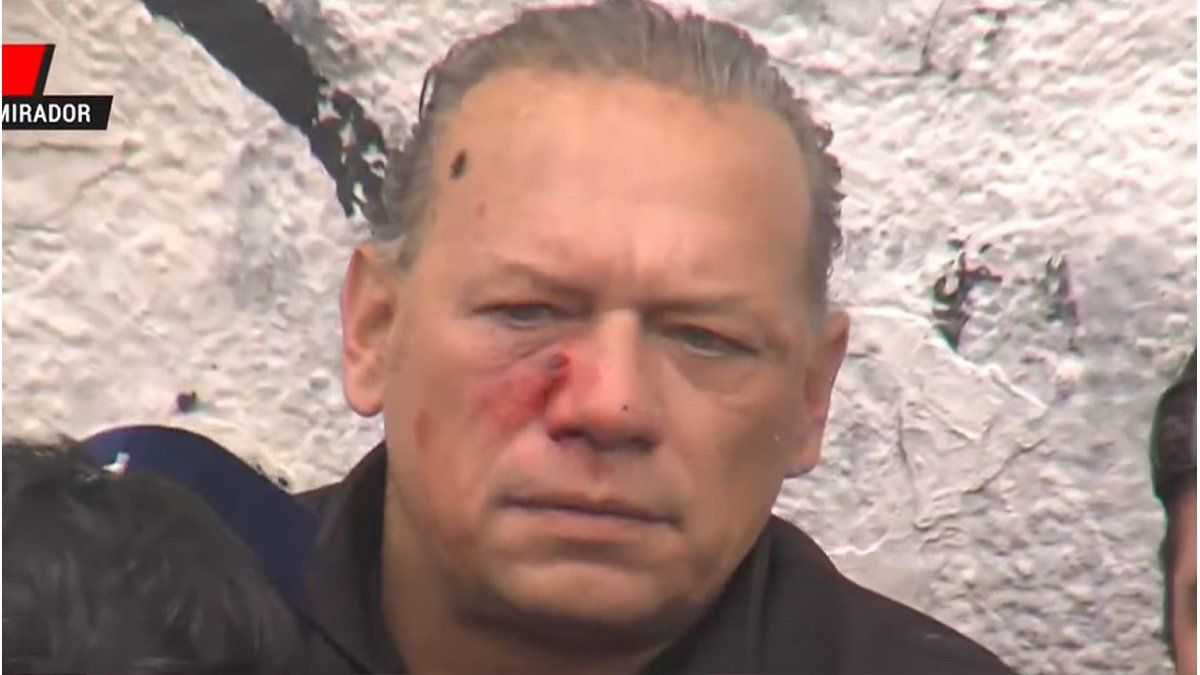 Ataque a Sergio Berni: La oposición justifica, ¿sale fortalecido?