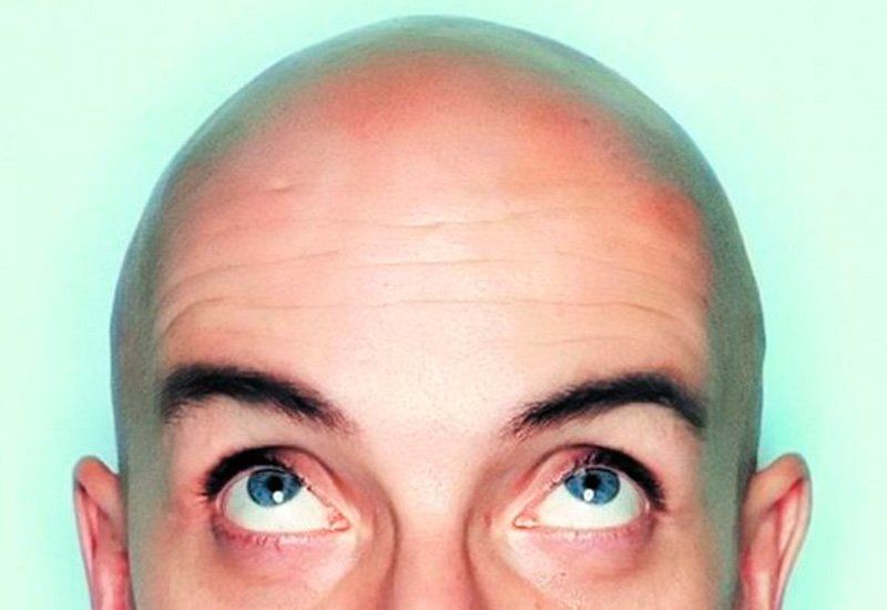 Ellas los prefieren calvos: Afirman que son más inteligentes y varoniles