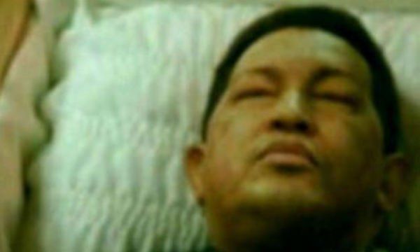 Difunden foto de Chávez muerto